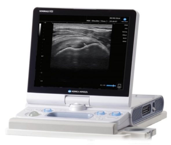 Ultrasound Guided Injection Derby, Nottingham & Leicester